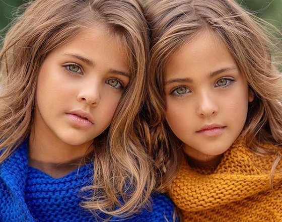 shayefpro.com > صور أجمل توأم في العالم، وانتقاد والدتهما بسبب إفساد طفولتهما